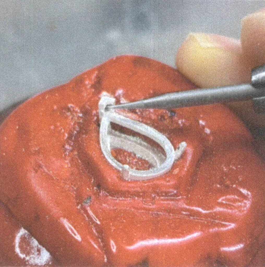 What is Prong Setting, Pave Setting, and Micro-pave Setting for jewelry ...